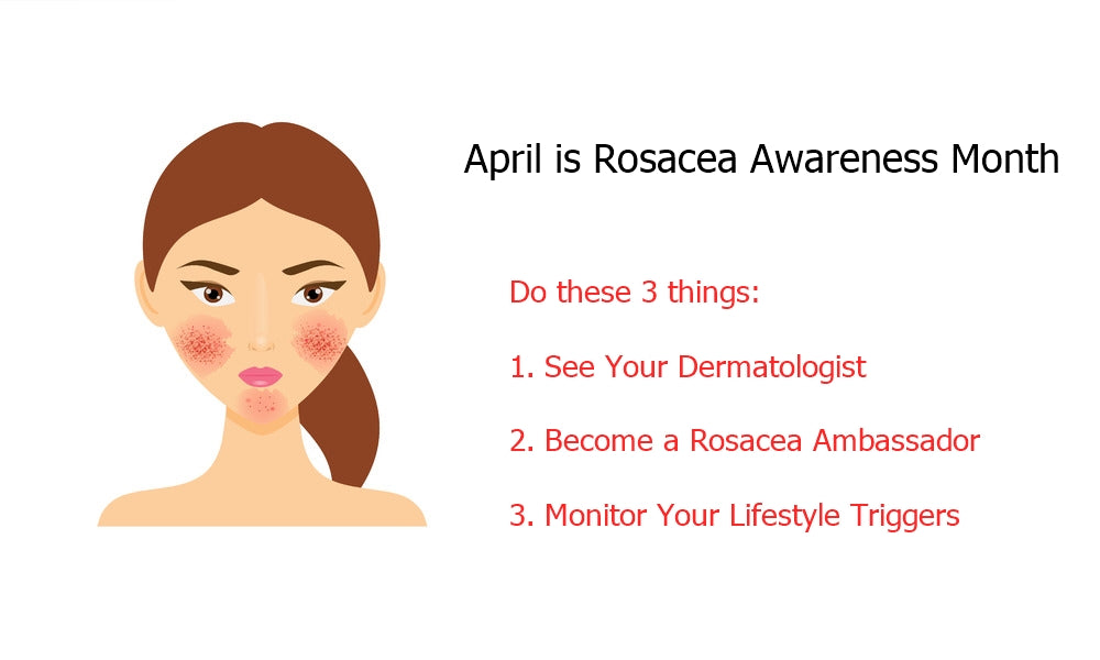 April is Rosacea Awareness Month – Apothekari Skincare